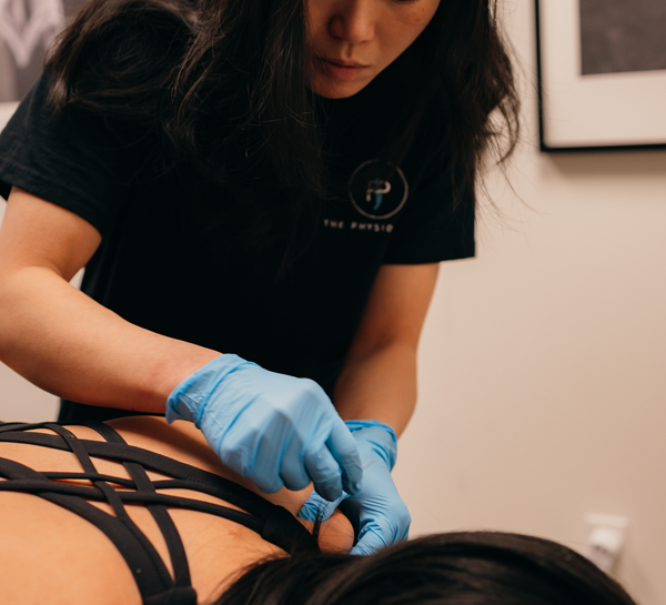 Dry Needling in Markham & Stouffville | Physiotherapy Treatment - The ...
